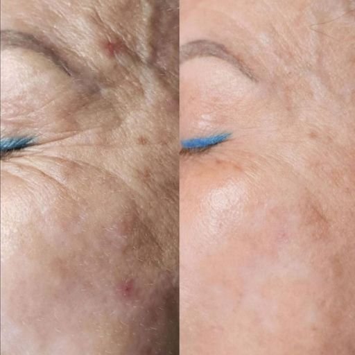 Synergy Laser and Med Spa – Spa Las vegas